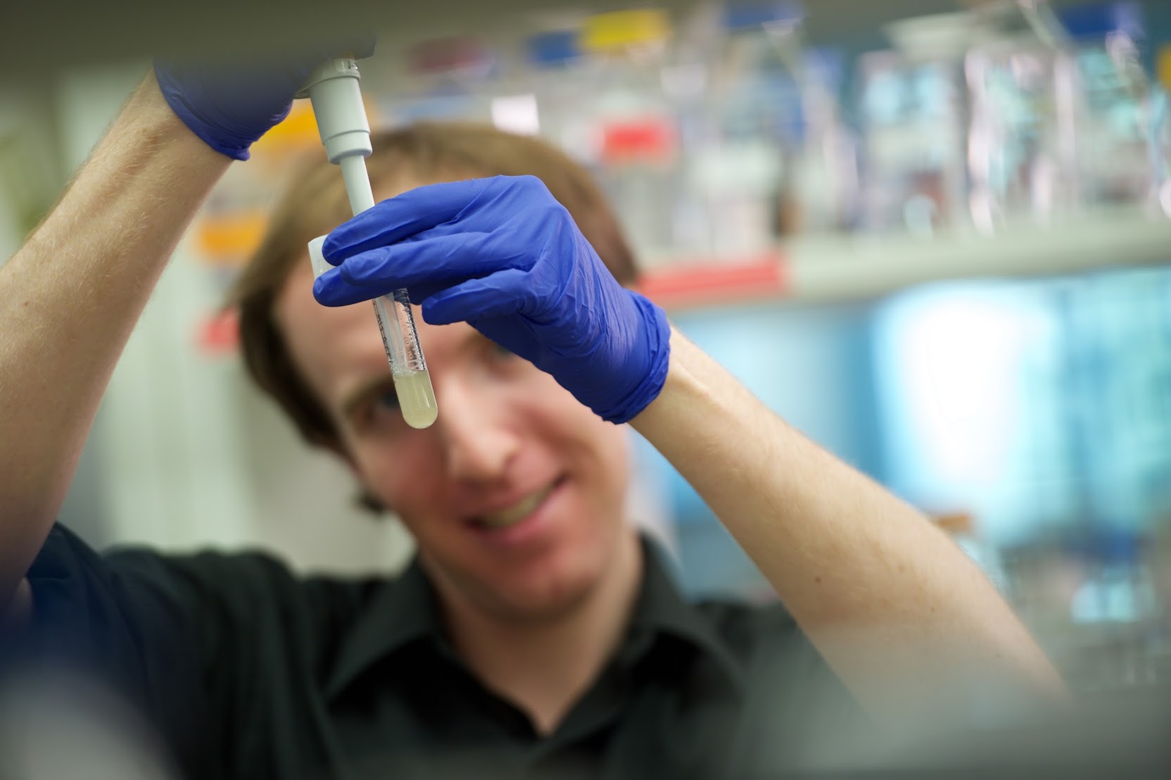 Yeast knockouts peel back secrets of cell protein function – CALS News
