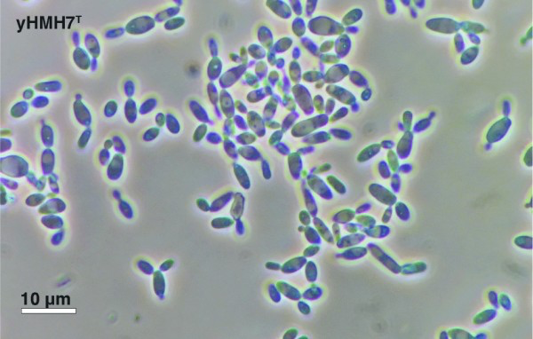 “Packers” yeast, identified by a UW–Madison undergrad, uncovers a ...